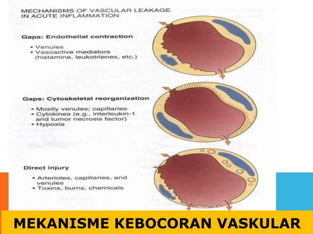Konsep Inflamasi pada pasien, inflamasi adalah proses peradangan | PPT