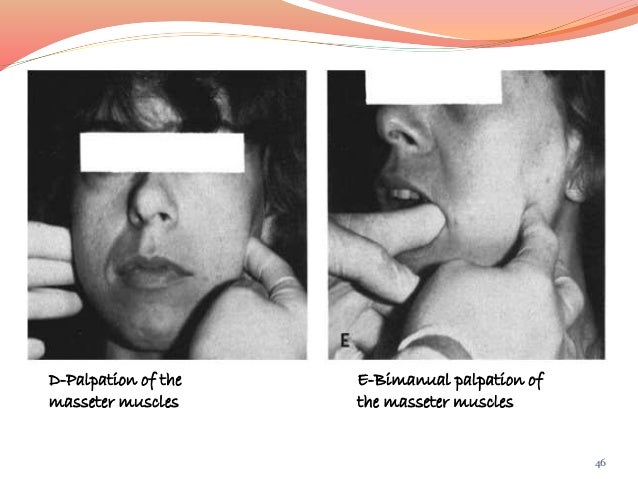 46959379 muscles-of-mastication-2010-newer-vwersion