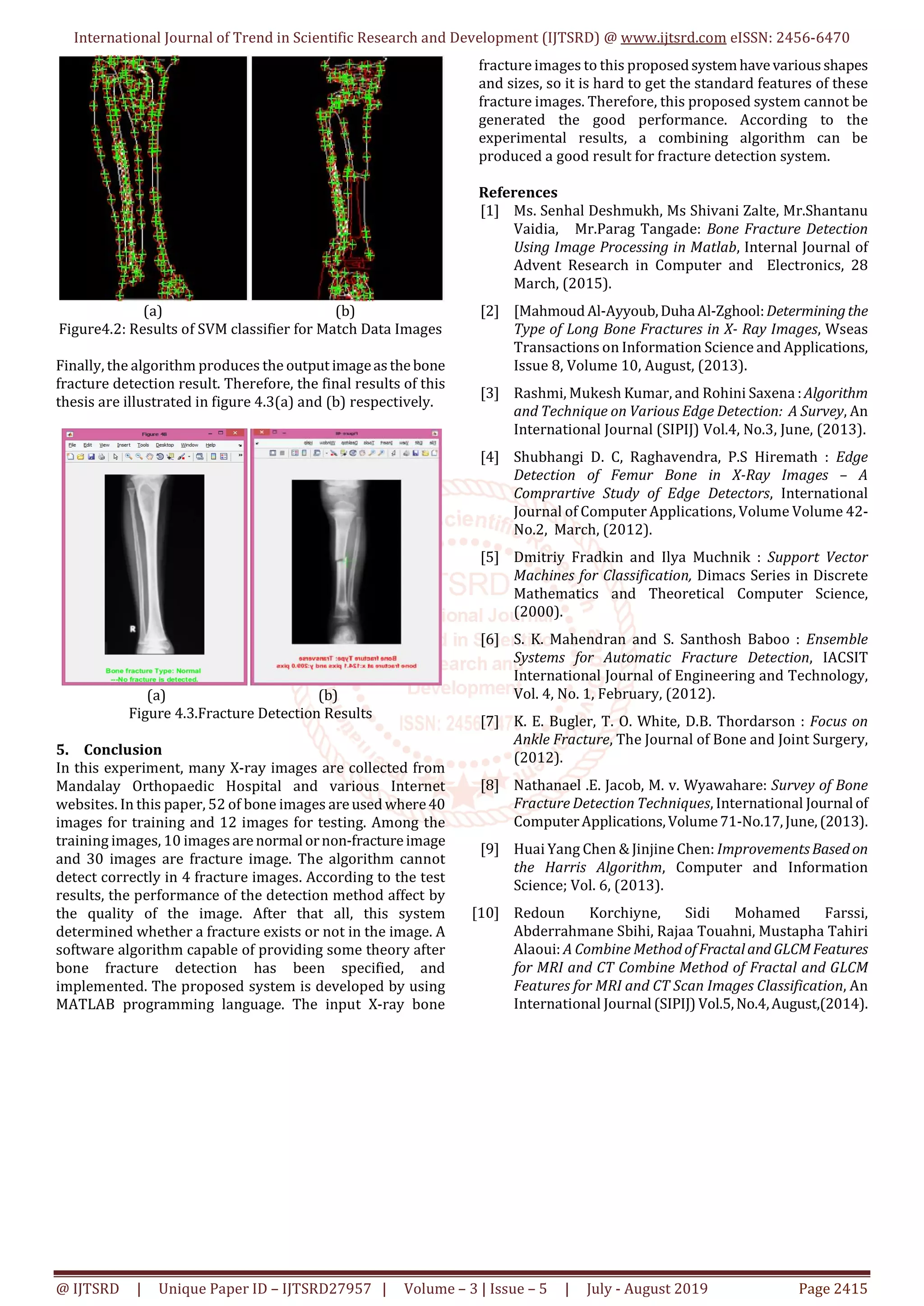 Implementation Of Lower Leg Bone Fracture Detection From X Ray Images Pdf