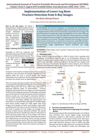 Implementation of Lower Leg Bone Fracture Detection from X Ray Images | PDF