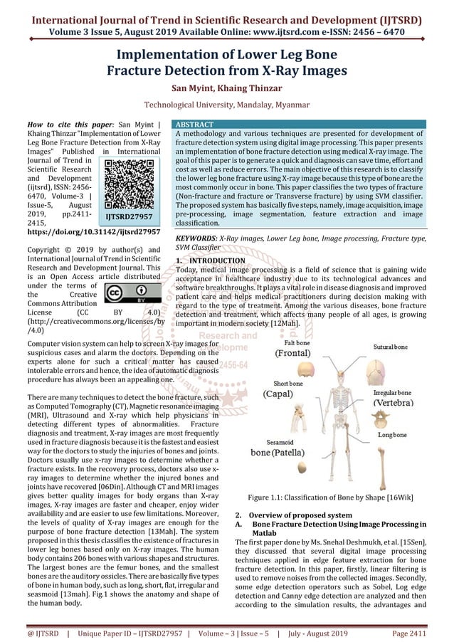 Implementation of Lower Leg Bone Fracture Detection from X Ray Images | PDF
