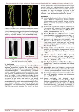 Implementation of Lower Leg Bone Fracture Detection from X Ray Images | PDF