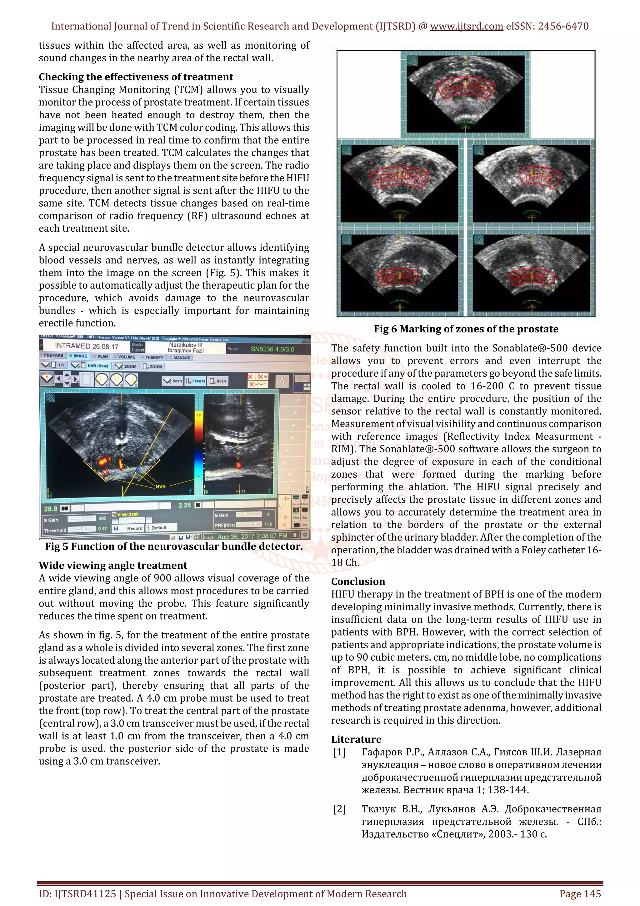 Role of HIFU Therapy in Treatment of Benign Prostate Hyperplasia ...