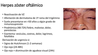 Conjuntivitis | PPTX