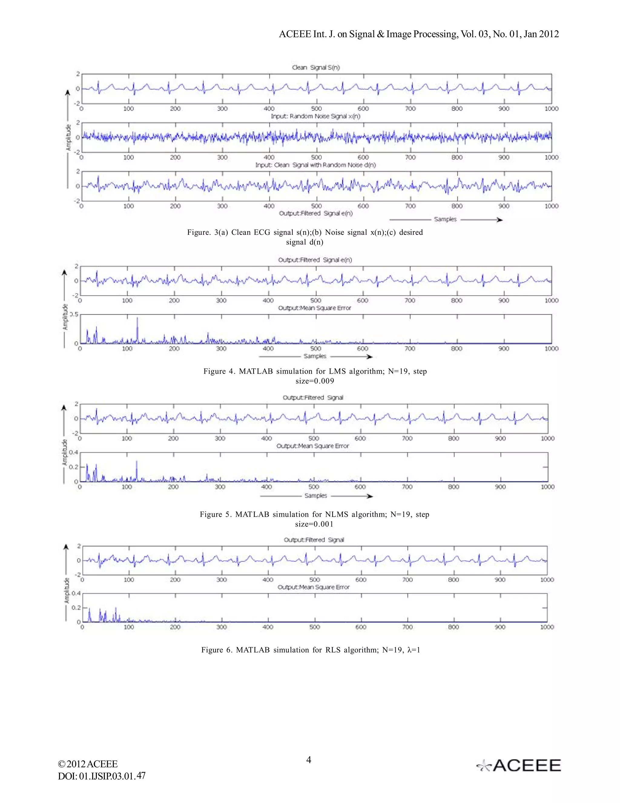 Simulation of Adaptive Noise Canceller for an ECG signal Analysis | PDF ...