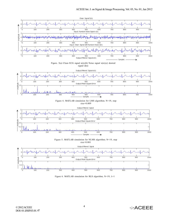 Simulation of Adaptive Noise Canceller for an ECG signal Analysis | PDF | Digital Audio ...