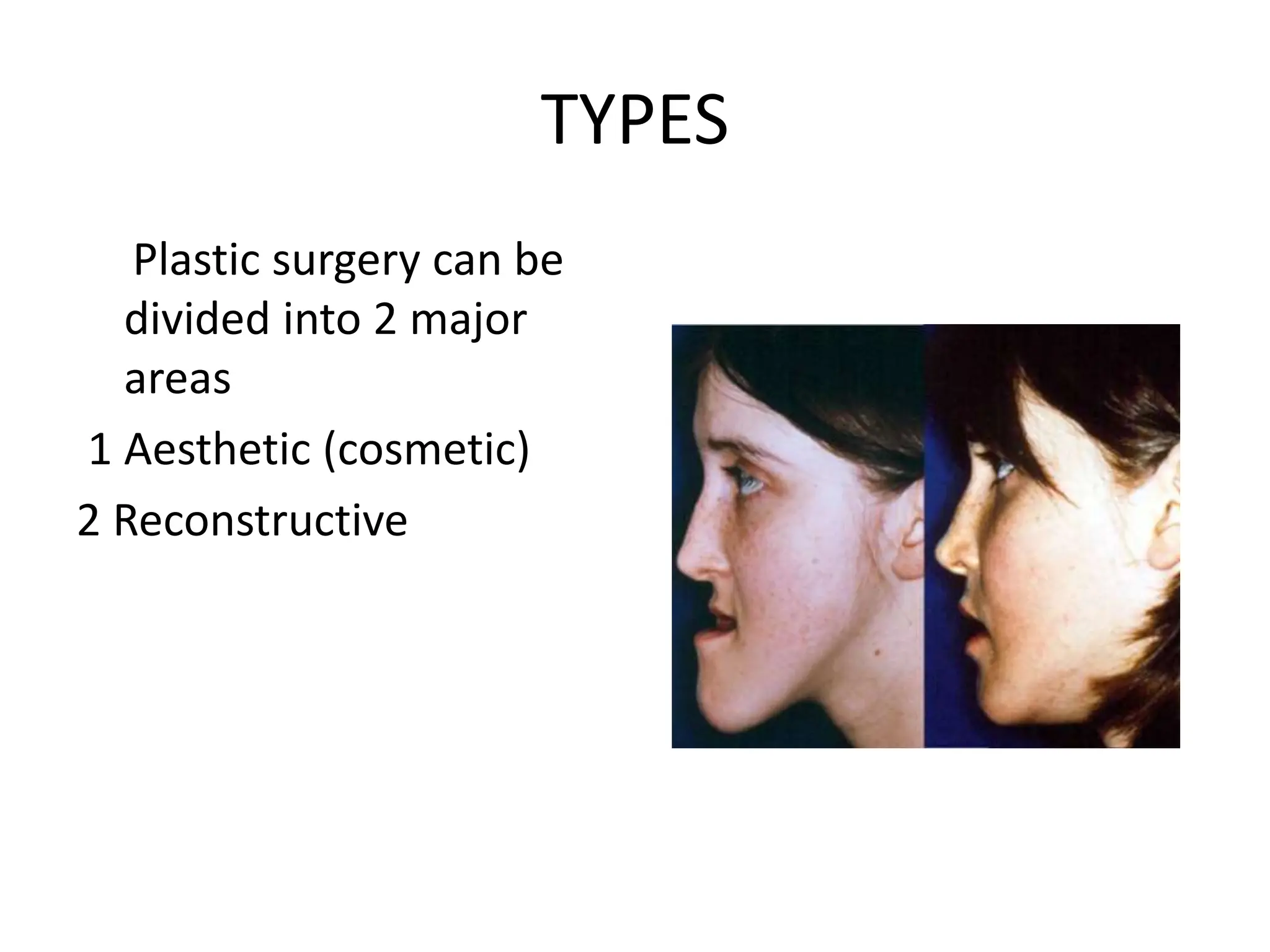 470329282-Types-of-reconstructive-cosmetic-surgery.pptx | Skin and ...