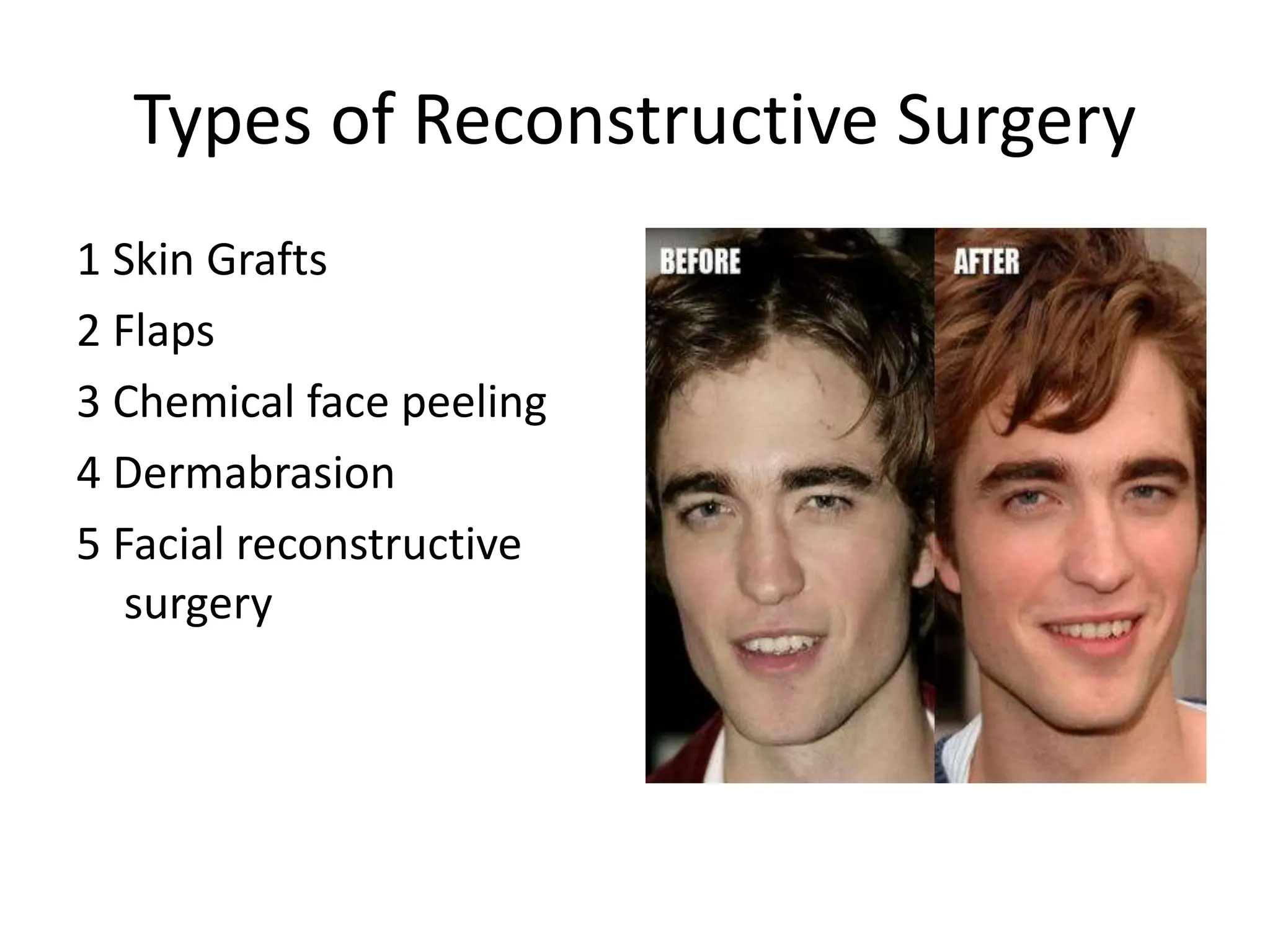 470329282-Types-of-reconstructive-cosmetic-surgery.pptx | Skin and ...