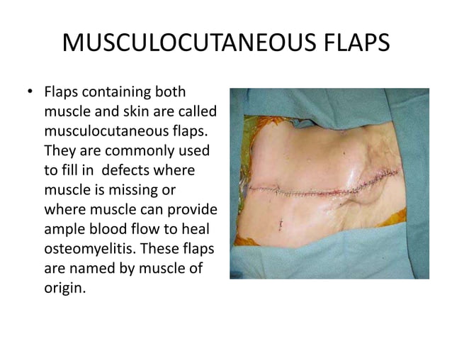 470329282-Types-of-reconstructive-cosmetic-surgery.pptx | Skin and ...