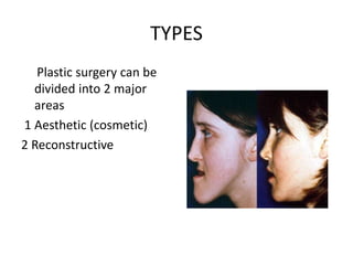 470329282-Types-of-reconstructive-cosmetic-surgery.pptx | Skin and ...