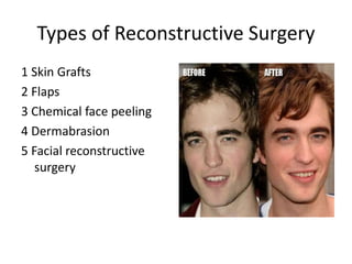 470329282-Types-of-reconstructive-cosmetic-surgery.pptx