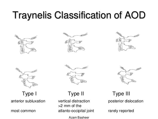 Upper C-spine Fractures Azam Basheer
