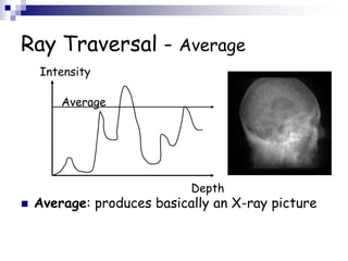 Direct Volume Rendering (DVR): Ray-casting | PPT
