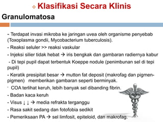 uveitis-anterior-referat | PPTX
