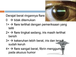 uveitis-anterior-referat | PPTX