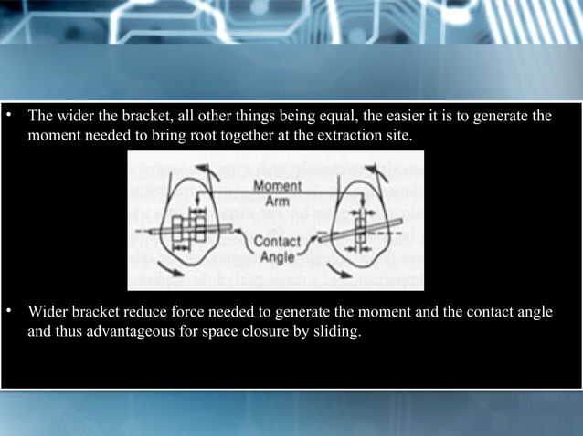 Friction vs Friction less mechanics in orthodontic space closure | PPTX