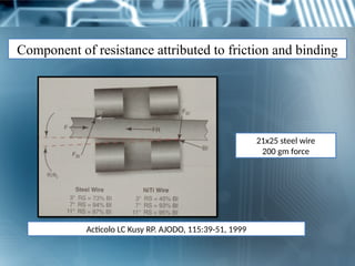 Friction vs Friction less mechanics in orthodontic space closure | PPTX