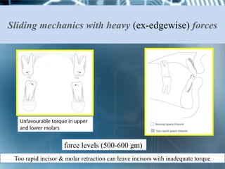 Friction vs Friction less mechanics in orthodontic space closure | PPTX