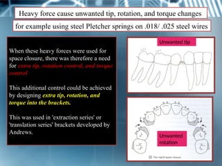 Friction vs Friction less mechanics in orthodontic space closure | PPTX