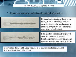 Friction vs Friction less mechanics in orthodontic space closure | PPTX