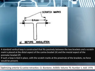 Friction vs Friction less mechanics in orthodontic space closure | PPTX