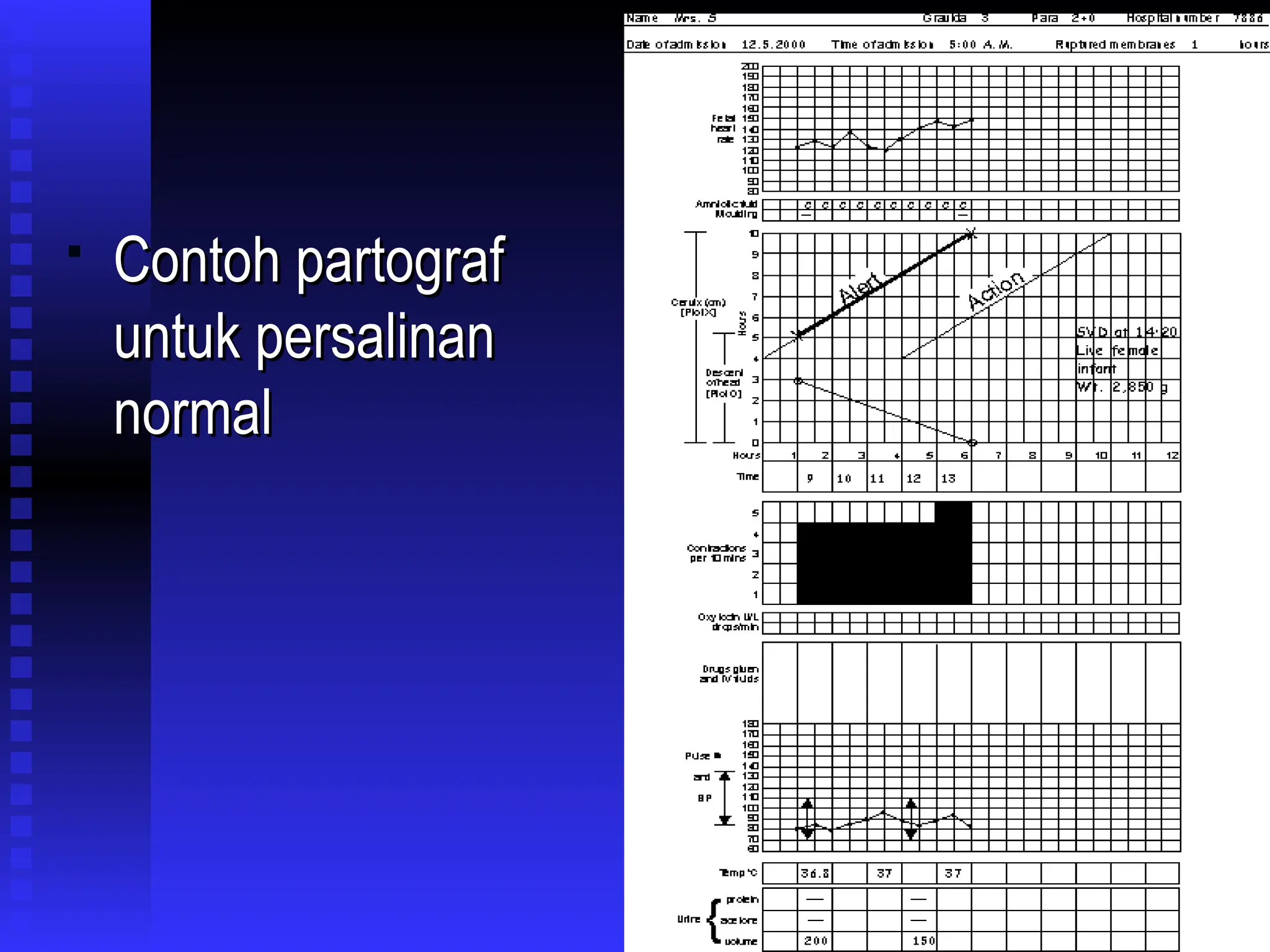 479812566-PARTOGRAF-ppt.ppt alat pemantau persalianan | PPT
