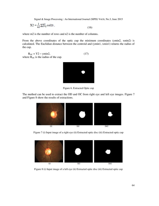FUZZY CLUSTERING BASED GLAUCOMA DETECTION USING THE CDR | PDF