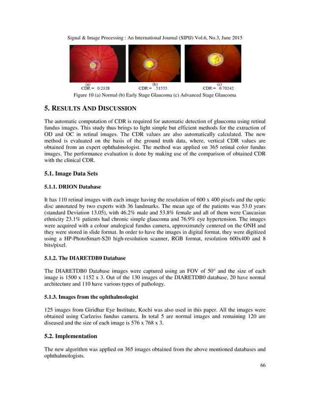 Fuzzy Clustering Based Glaucoma Detection Using The Cdr Pdf