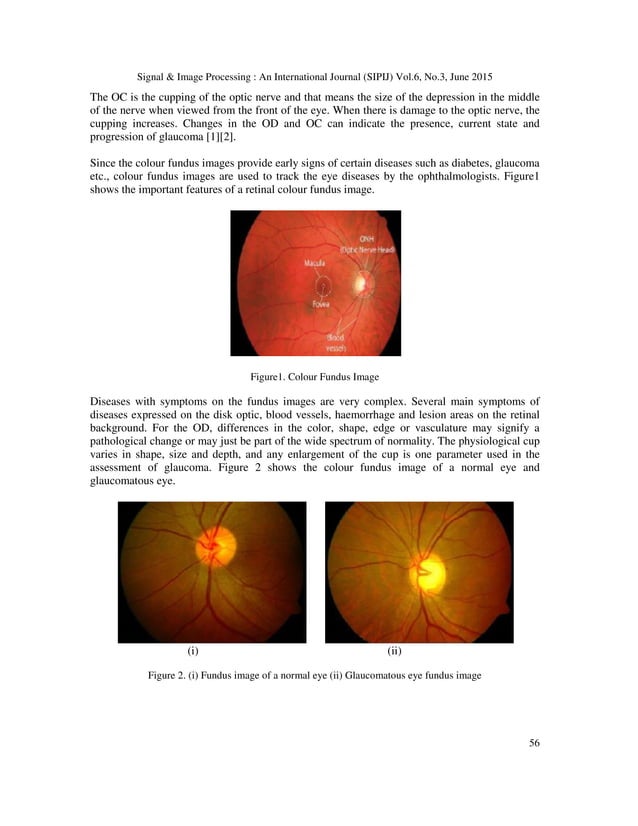 FUZZY CLUSTERING BASED GLAUCOMA DETECTION USING THE CDR | PDF