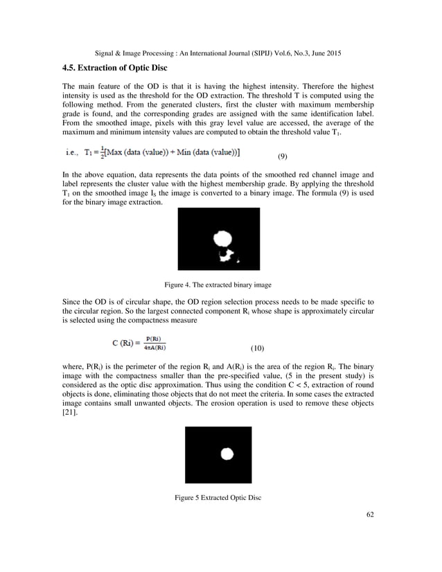 Fuzzy Clustering Based Glaucoma Detection Using The Cdr Pdf