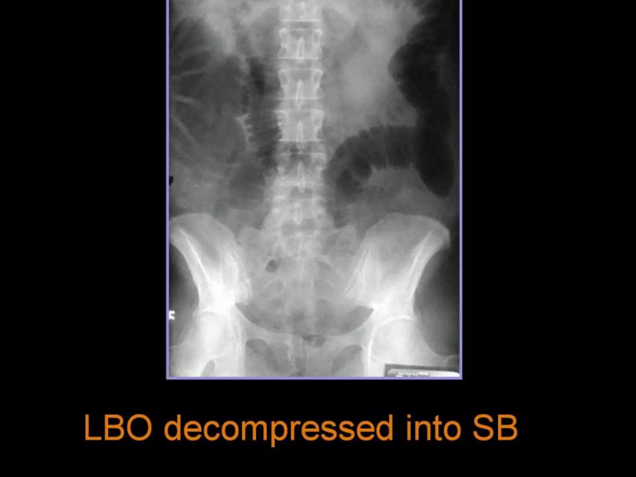 48 Dr Ahmed Esawy imaging oral board of bowel imaging (mesenteric ...