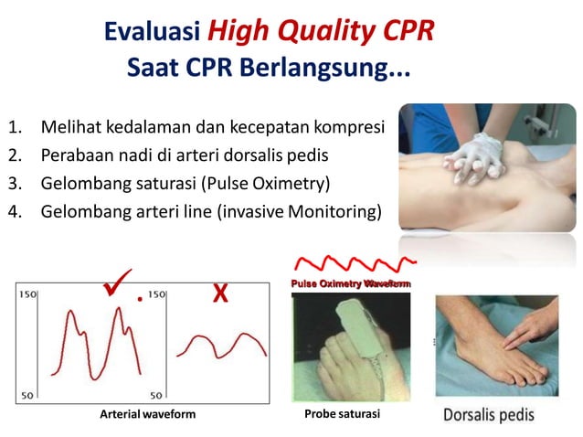 480963324-BLS-AHA-2020-PPT-pptx.pptx