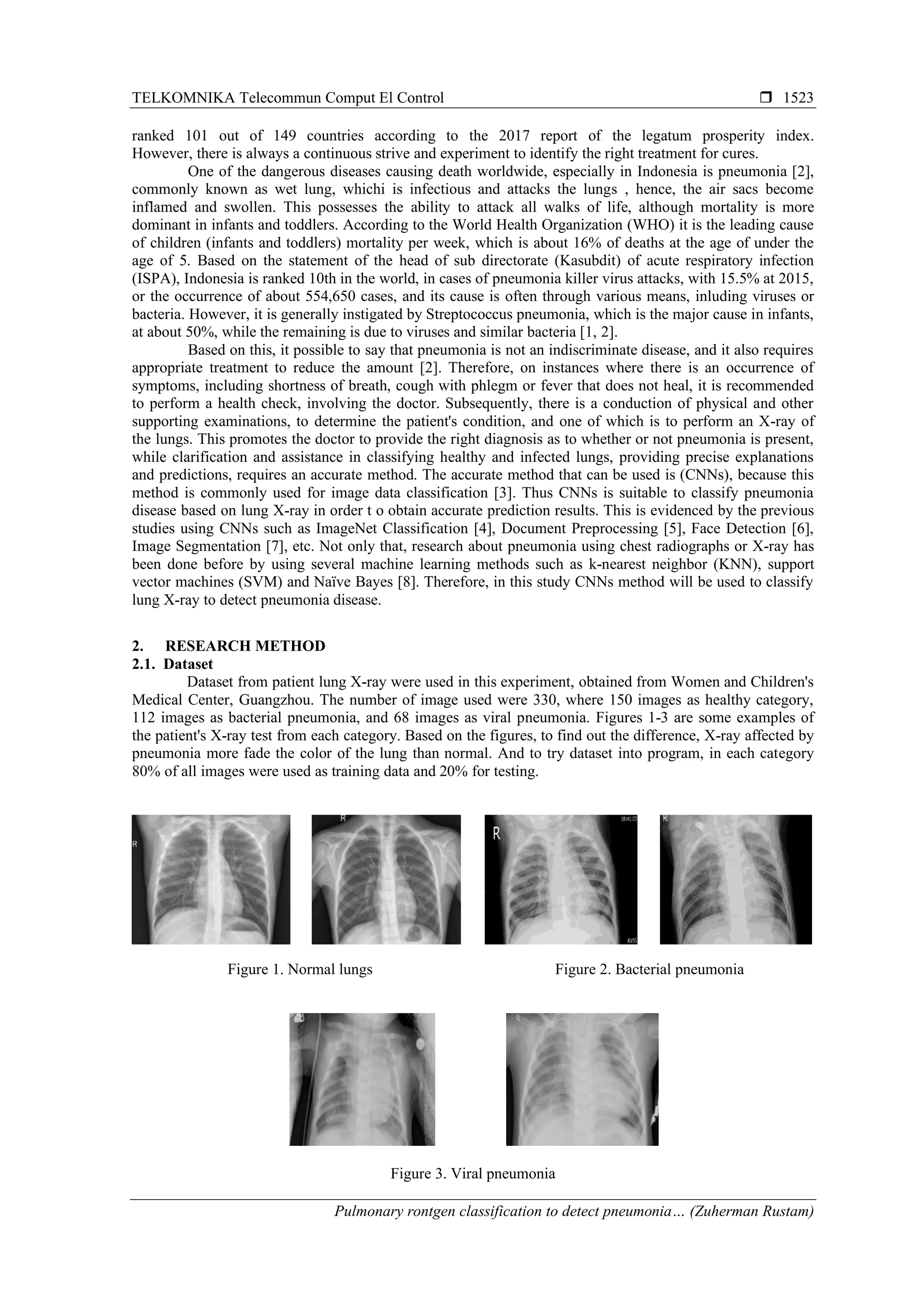 Pulmonary rontgen classification to detect pneumonia disease using convolutional neural networks ...