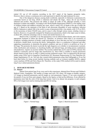 Pulmonary rontgen classification to detect pneumonia disease using convolutional neural networks ...
