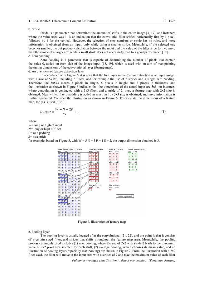 Pulmonary rontgen classification to detect pneumonia disease using convolutional neural networks ...