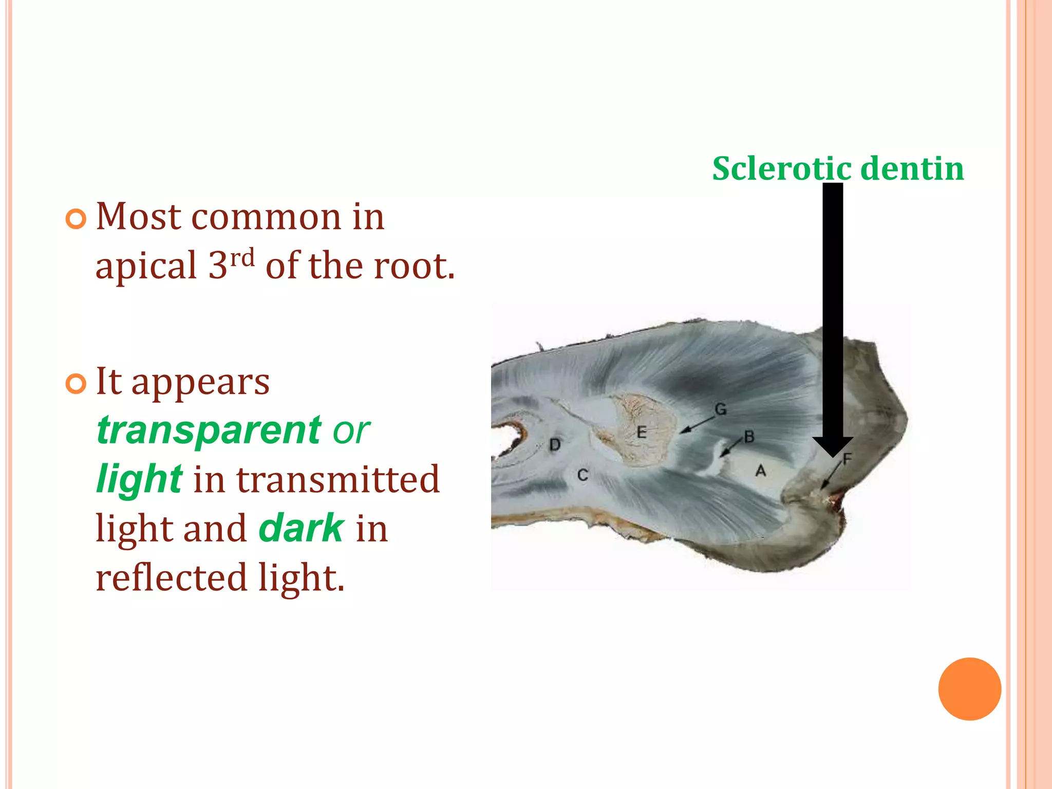 age change in dental hard tissue | PPTX