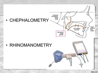 oral habits and mouth breathing | PPTX