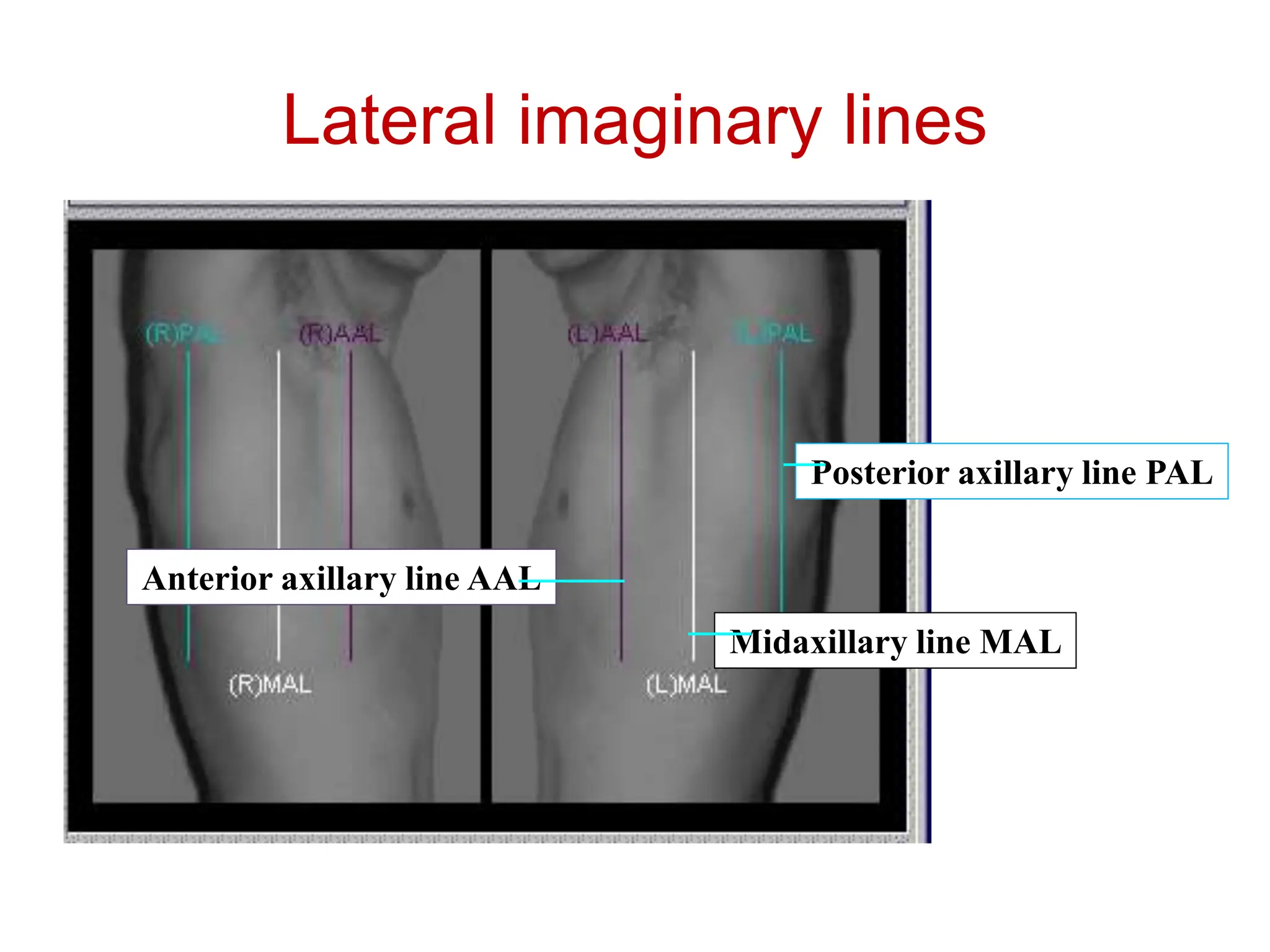 482003013-Physical-examination-in-respiratory-system-ppt.ppt