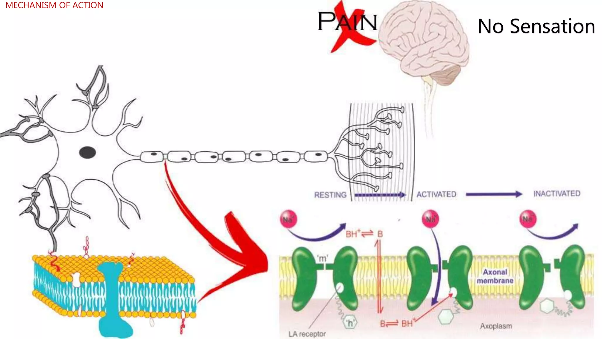 Local anesthesia Mechanism Of Action as well as types | PPTX