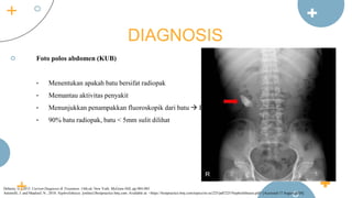 485349147-Nefrolitiasis-BST-dr-Bungaran-pptx.pptx