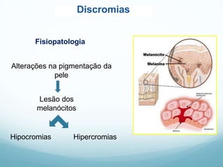 DISTURBIOS DE PIGMENTACAO | PPTX