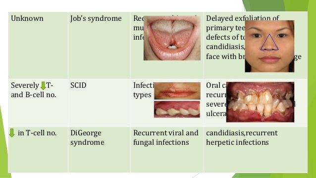 486 immunoogic disorders
