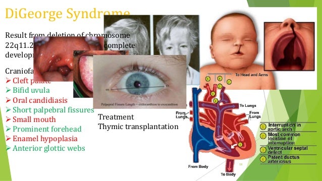 486 immunoogic disorders