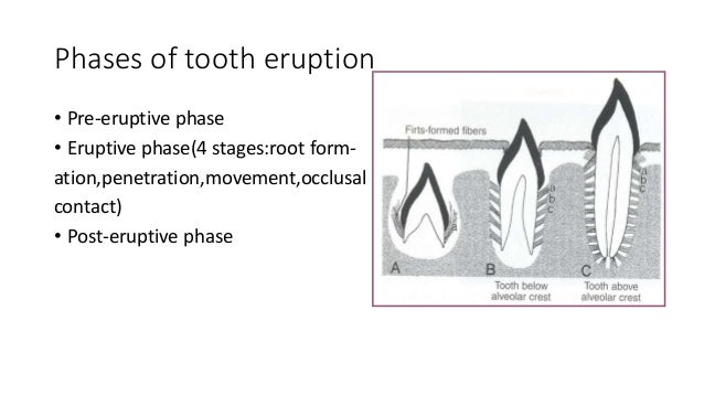 486 Theories Of Tooth Eruption