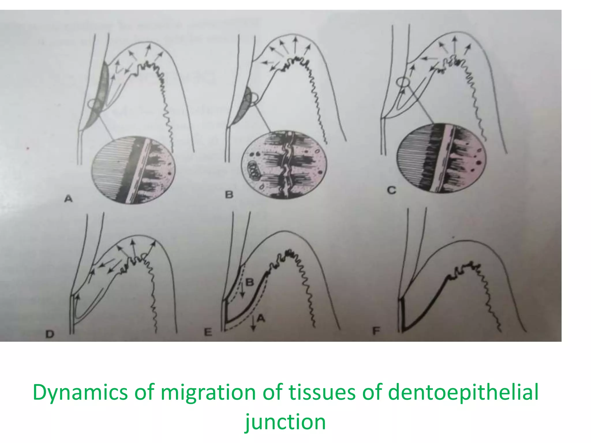 486 junctional epithelium | PPTX