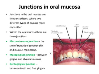 486 junctional epithelium | PPTX