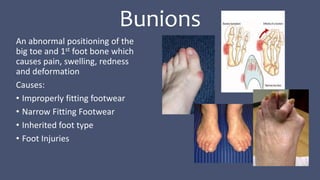 Happy Healthy Feet | PPTX