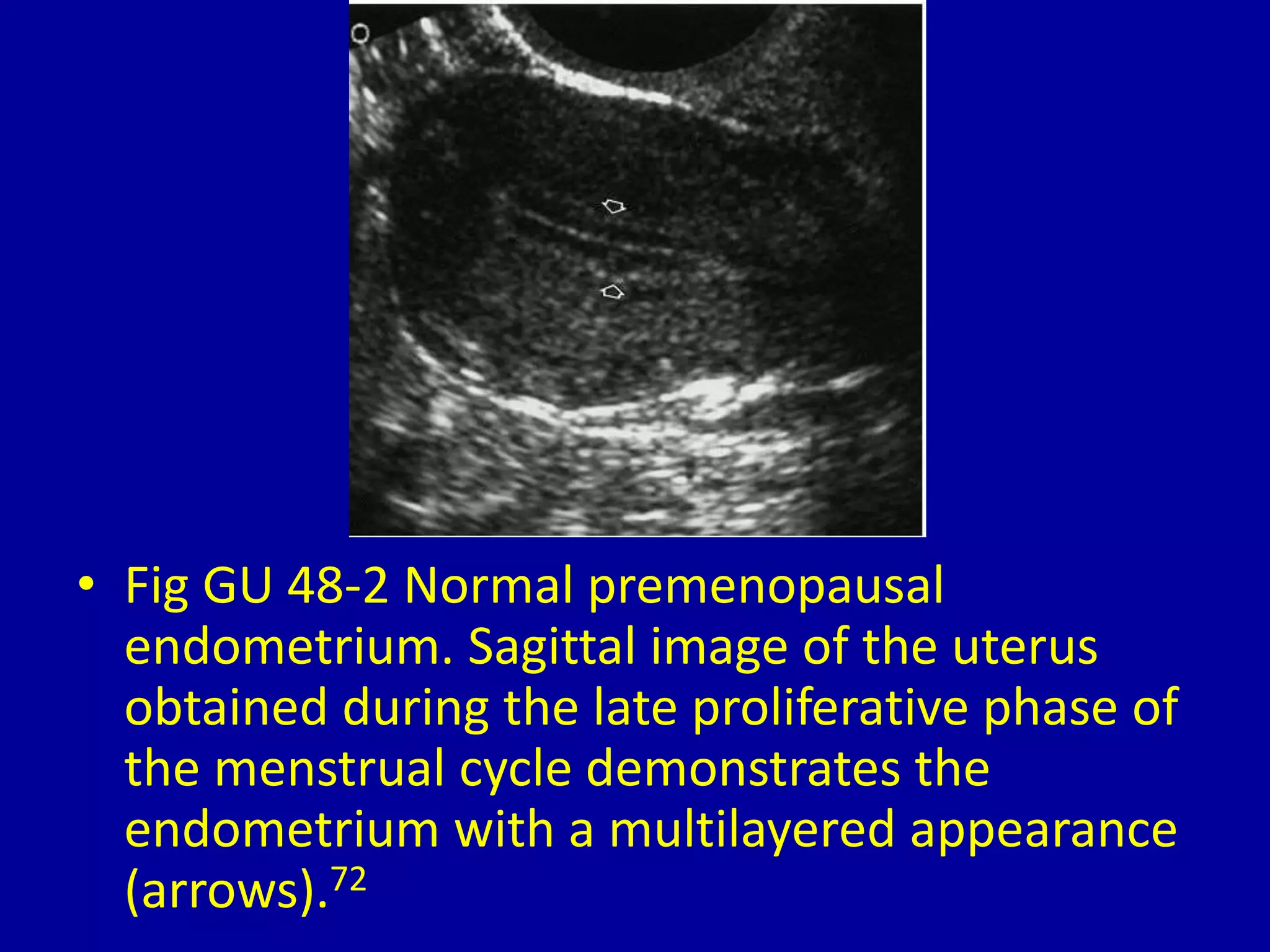 48 the endometrium | PPTX