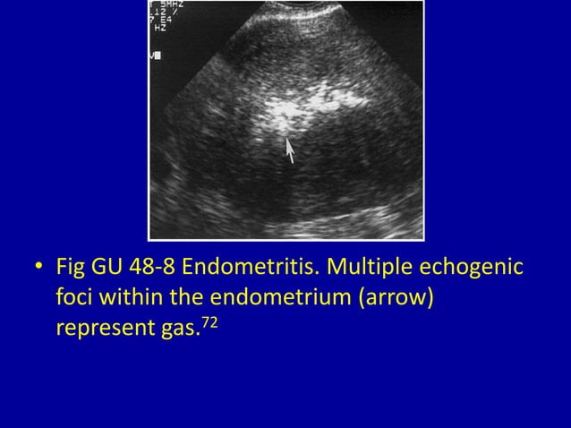48 the endometrium | PPTX