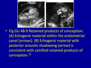 48 the endometrium | PPTX